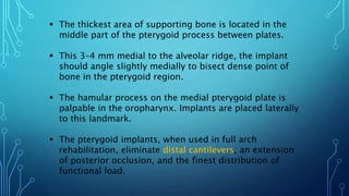 Pterygoid Implants | PPTX