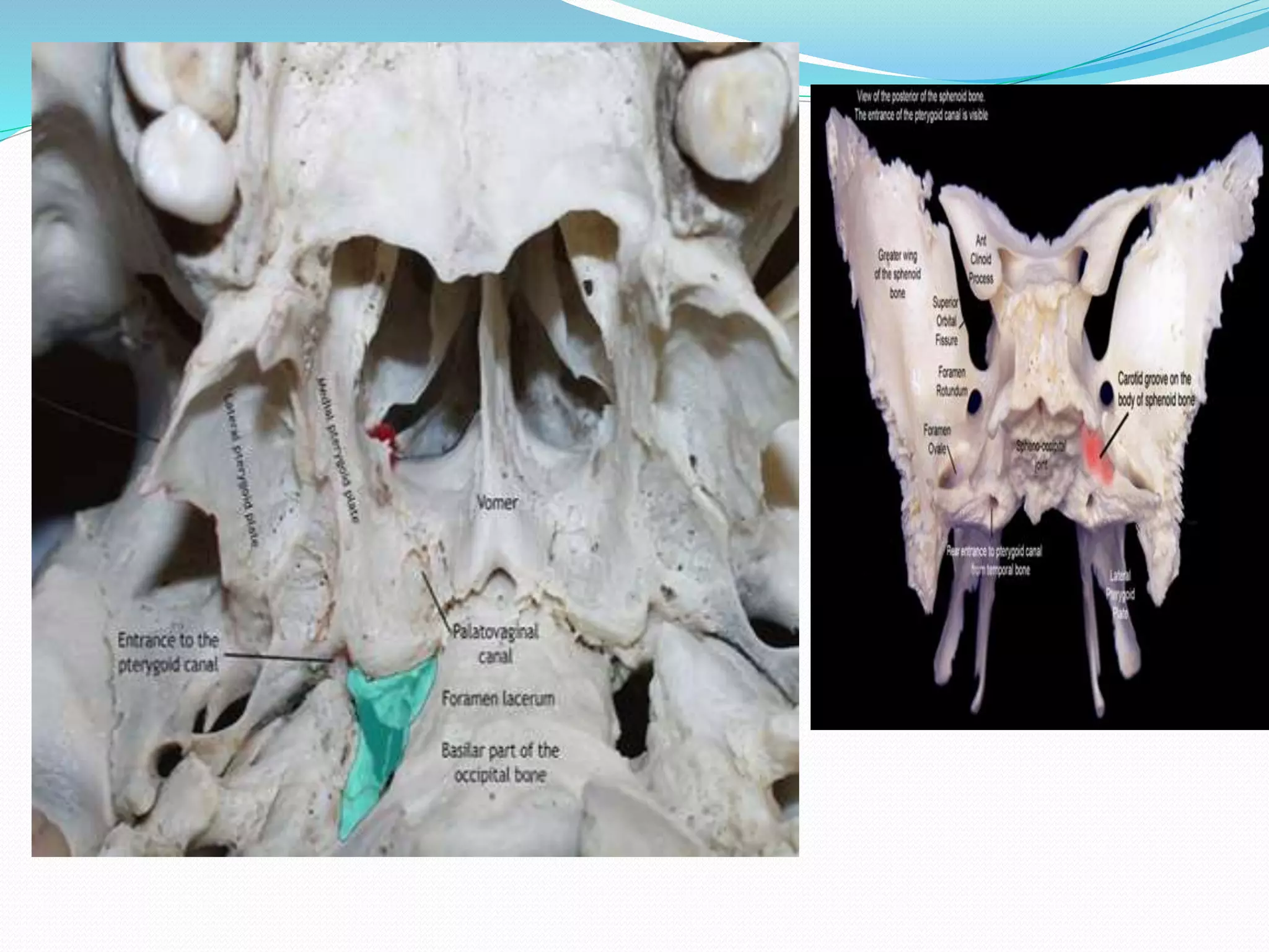 Pterygopalatine fossa.pptx