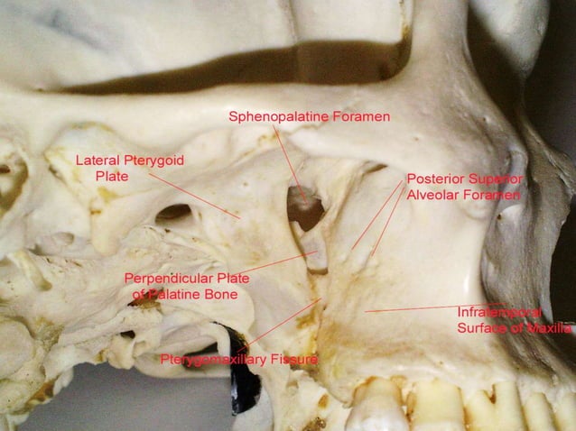 Pterygopalatine fossa and approaches by Dr.Ashwin Menon | PPTX | Ear ...