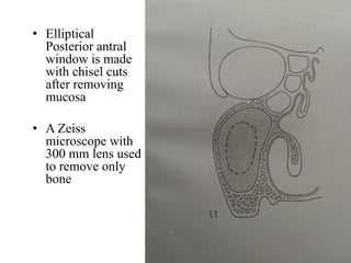 Pterygopalatine fossa and approaches by Dr.Ashwin Menon | PPTX