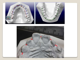 Patient evaluation for orthodontic Treatment | PPTX