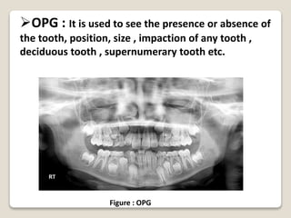 Patient evaluation for orthodontic Treatment | PPTX