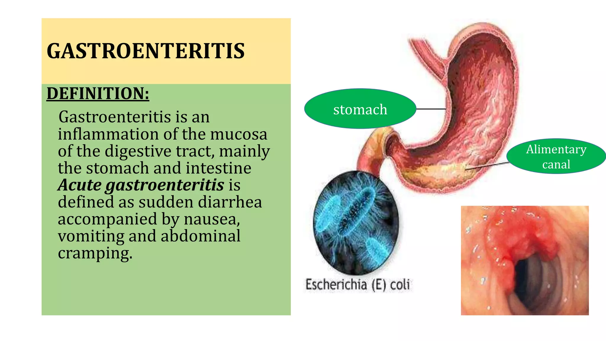 introduction of lower GI disorders | PPTX