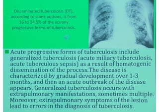 Acute progressive tuberculosis. Tuberculosis | PPT