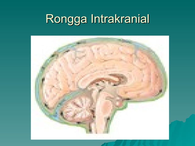 Peningkatan Tekanan Intrakranial | PPT