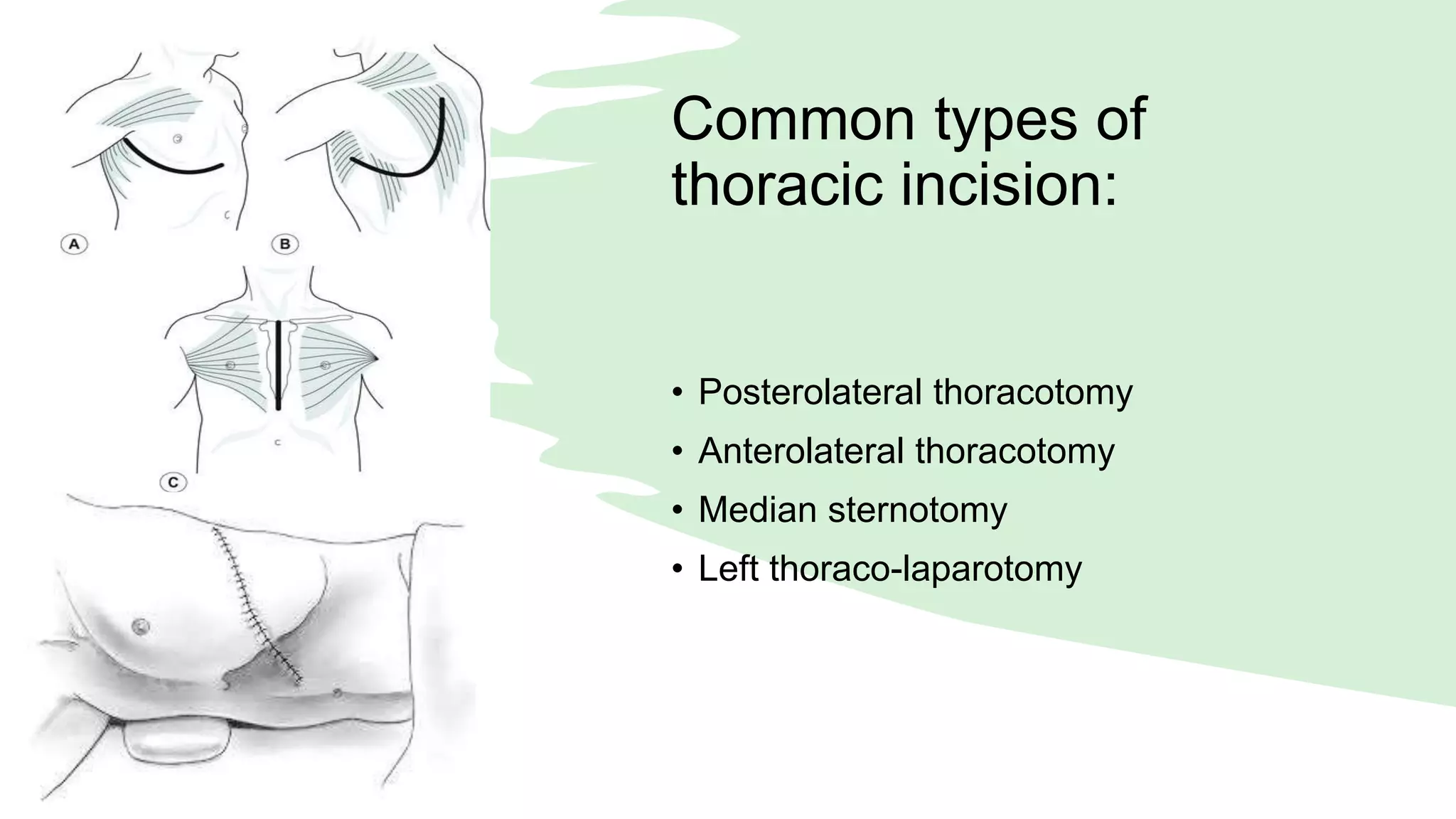Physiotherapy in surgery in abdominal and thoracic surgery | PPTX