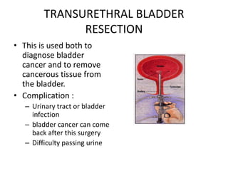 Pt in urosurgery | PPTX