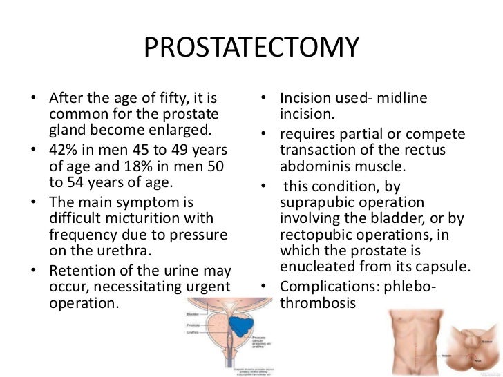 Pt in urosurgery