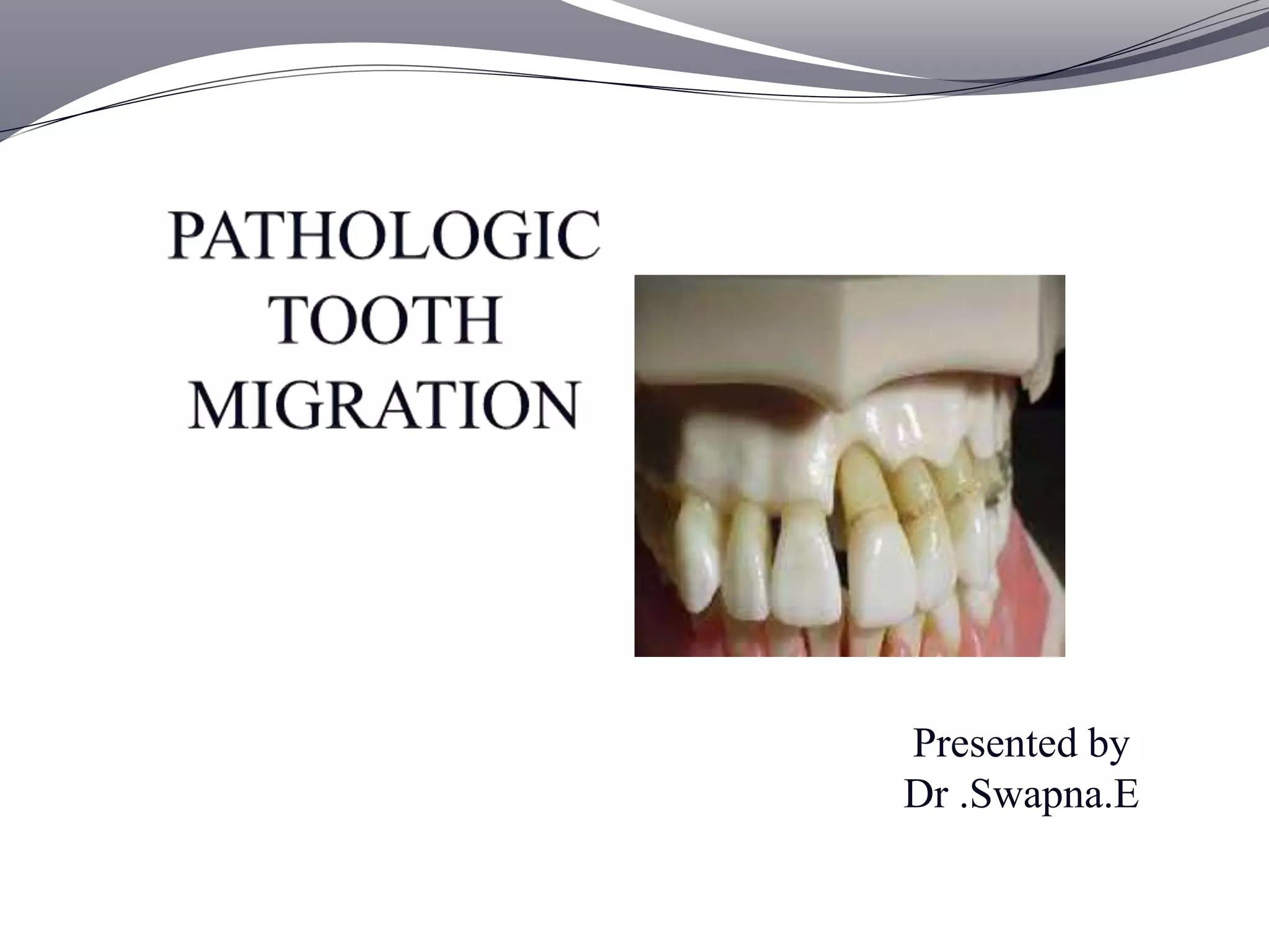 PATHOLOGIC TOOTH MIGRATION .pptx