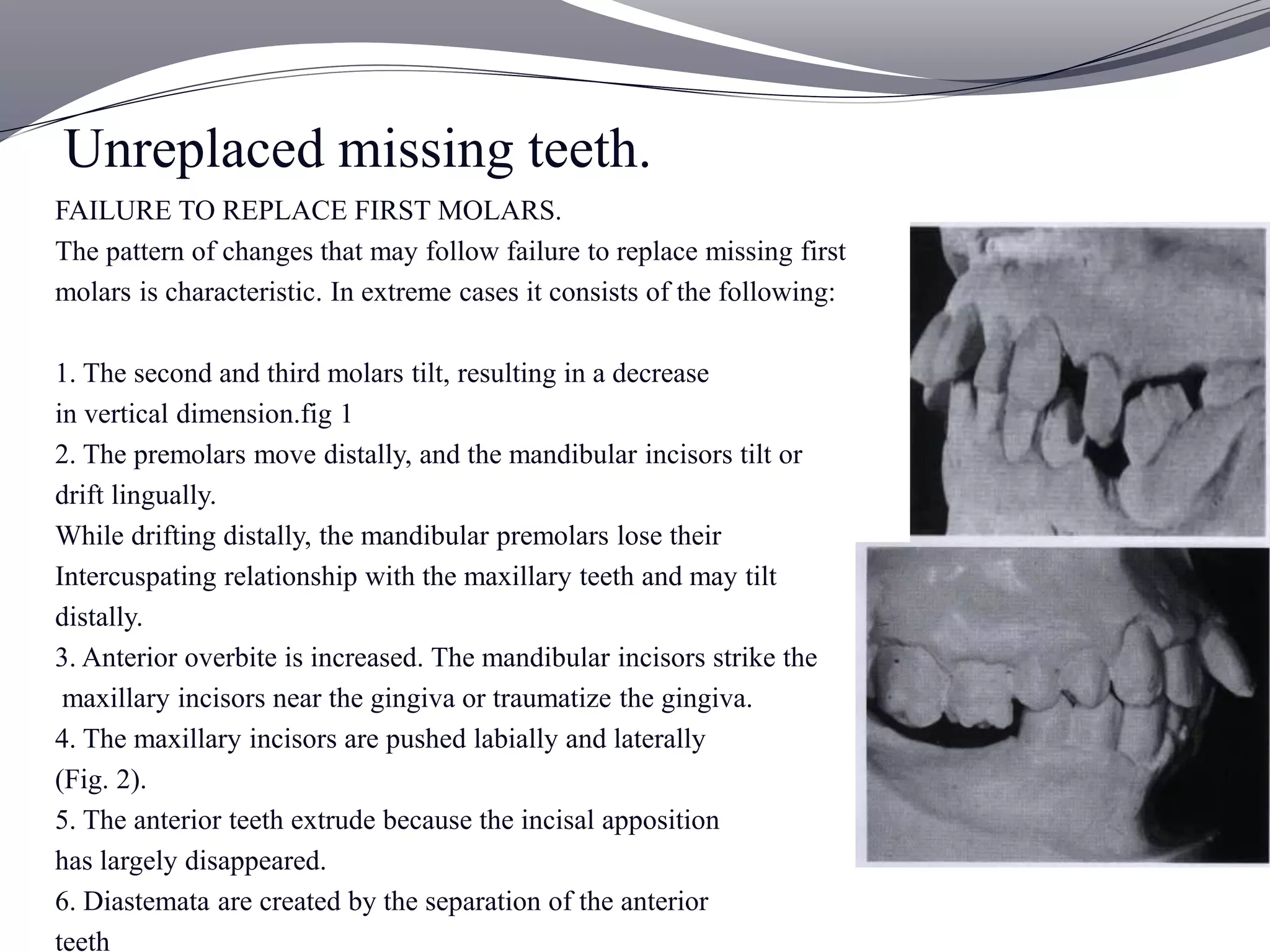 PATHOLOGIC TOOTH MIGRATION .pptx