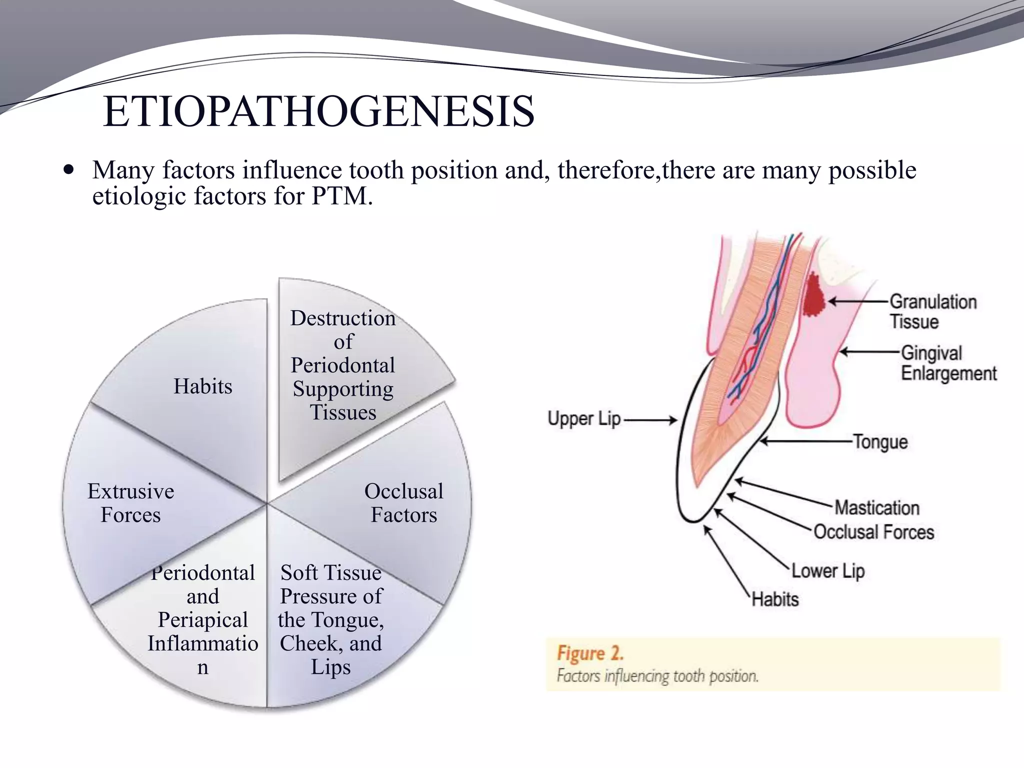 PATHOLOGIC TOOTH MIGRATION .pptx