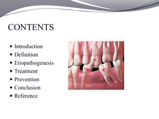 PATHOLOGIC TOOTH MIGRATION .pptx