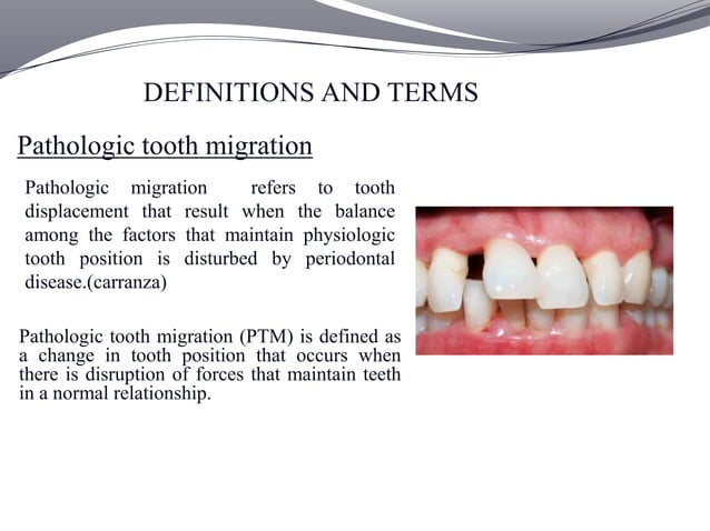 PATHOLOGIC TOOTH MIGRATION .pptx