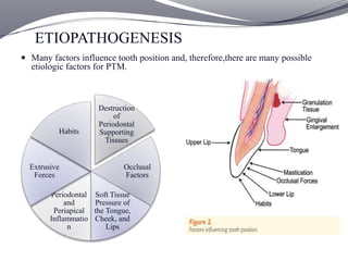 PATHOLOGIC TOOTH MIGRATION .pptx