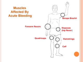 PT MANAGEMENT IN ACUTE BLEED | PPT