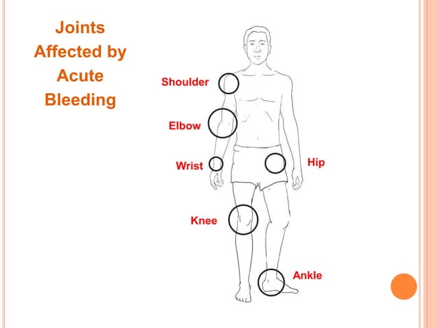 PT MANAGEMENT IN ACUTE BLEED | PPT