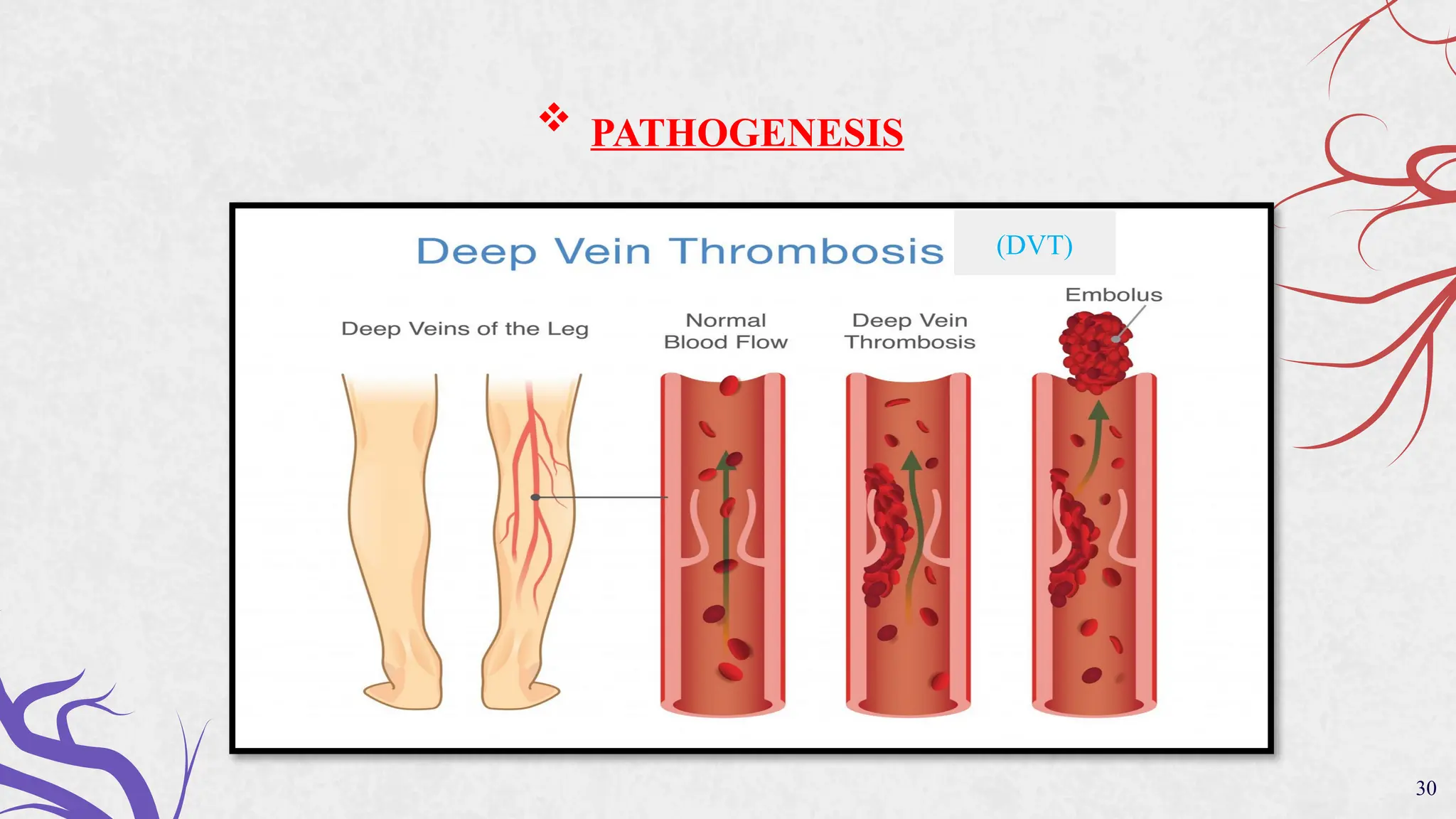 PT ASSESMENT AND MANAGEMENT IN VENOUS DISORDERS .pptx