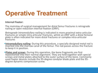 PT Management of Fractures of Condyles of Femur | PPTX