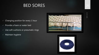 PT MANAGEMENT OF INFECTIONS OF BRAIN | PPTX