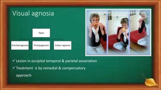 Physiotherapy management of perceptual disorders | PPTX