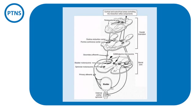 PTNS Percutaneous Tibial Nerve Stimulation | PPTX