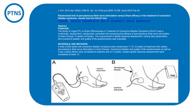 PTNS Percutaneous Tibial Nerve Stimulation