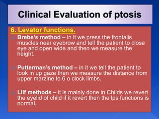 PTOSIS -Measurement and clinical evaluation | PPTX