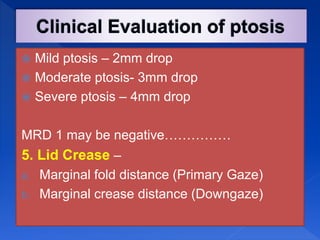 PTOSIS -Measurement and clinical evaluation | PPTX