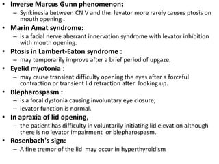 Ptosis | PPTX
