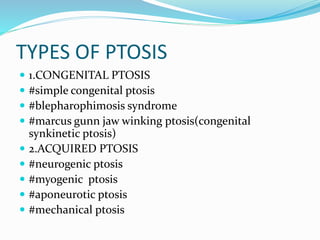 Ptosis | PPTX
