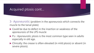 Ptosis | PPTX
