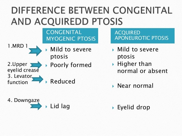 Ptosis