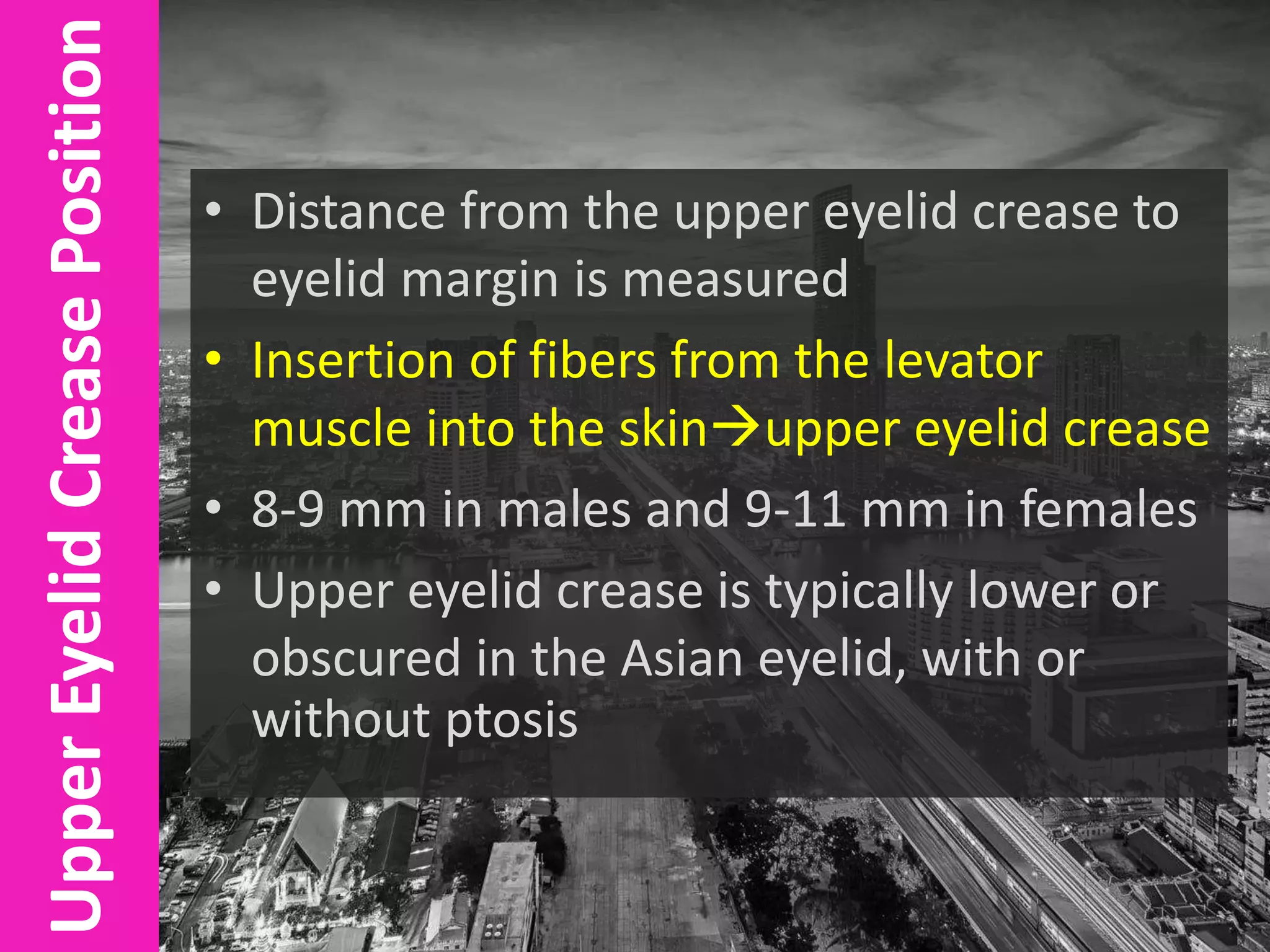 blepharoptosis | PPTX