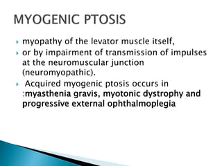 Ptosis eyelid disorders | PPTX