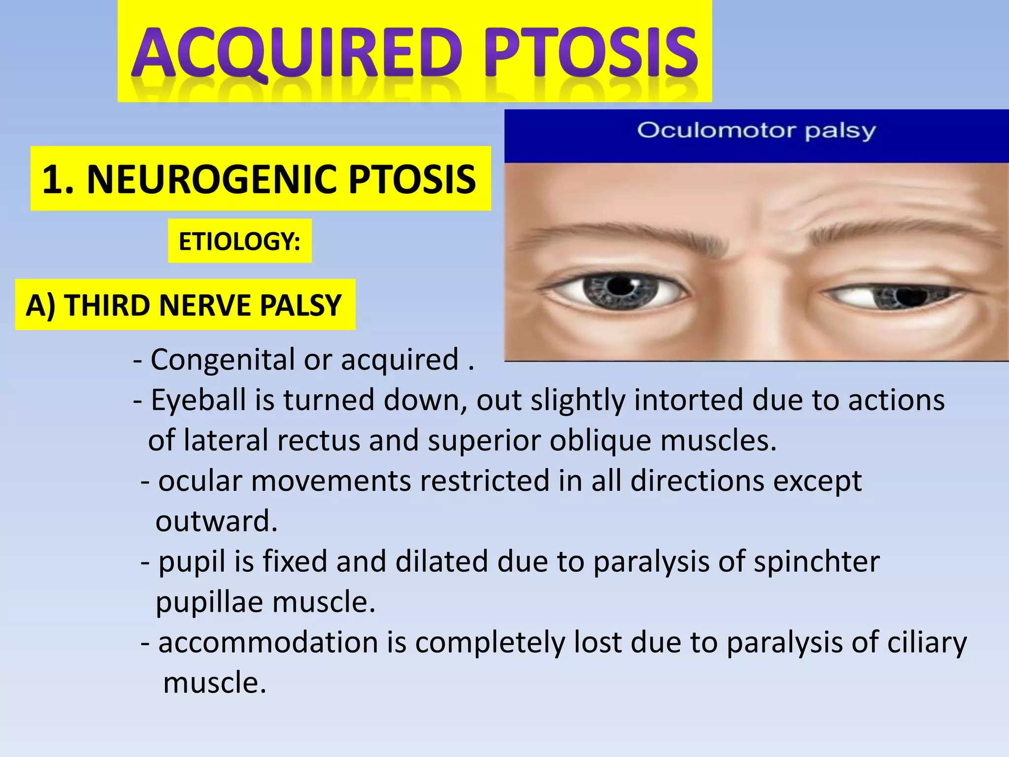 Ptosis | PPTX