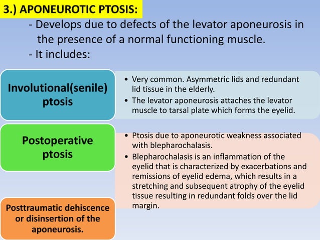 Ptosis | PPT