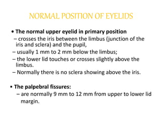 Ptosis | PPTX