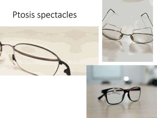 Ptosis | PPTX