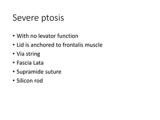 Ptosis | PPT