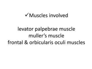 Ptosis ( Quick Review ) | PPTX