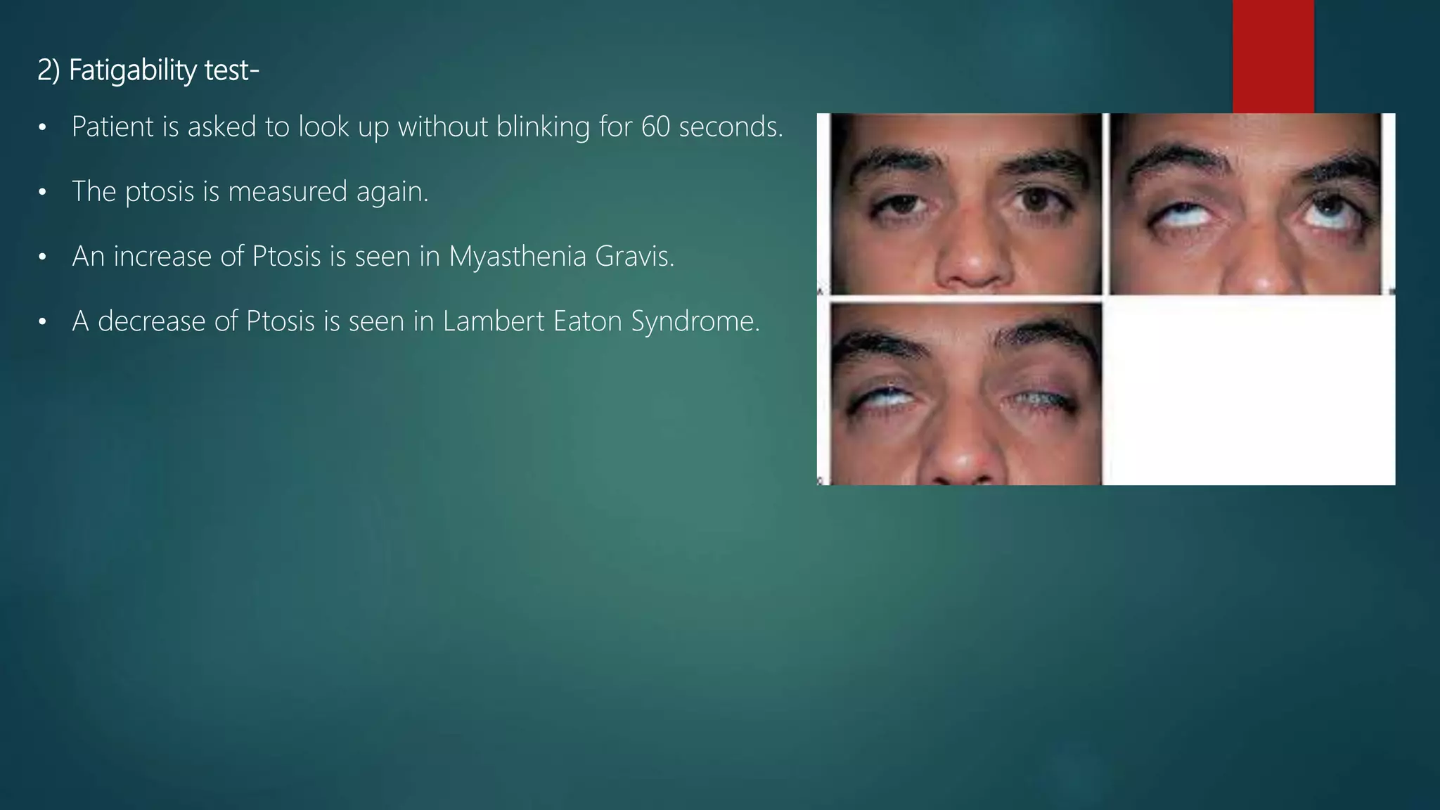 Ptosis | PPTX | Eye and Vision Conditions | Diseases and Conditions