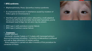 Ptosis | PPTX