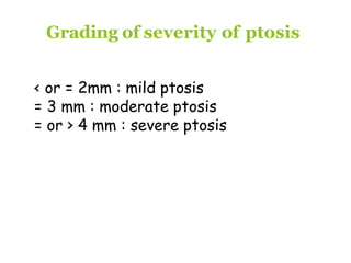 Ptosis | PPT