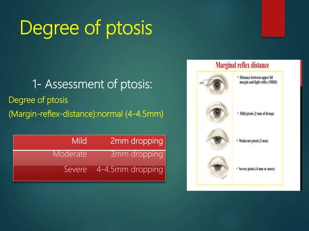 Ptosis | PPTX