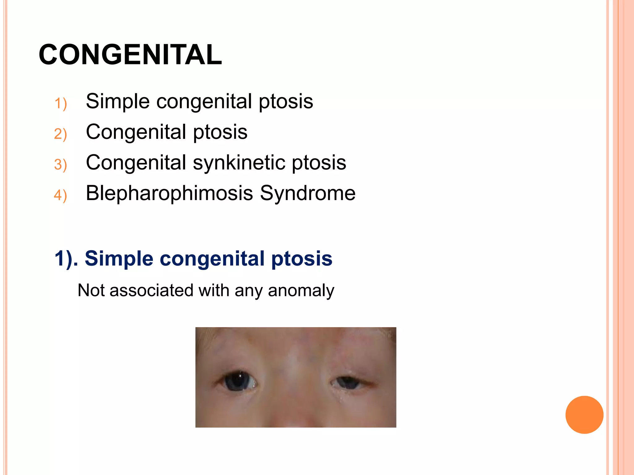 PTOSIS.pptx | Eye and Vision Conditions | Diseases and Conditions
