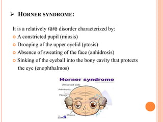 PTOSIS.pptx | Eye and Vision Conditions | Diseases and Conditions