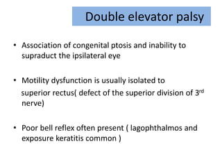ptosis.pptx