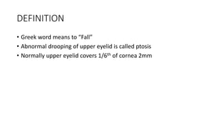 Ptosis.pptx