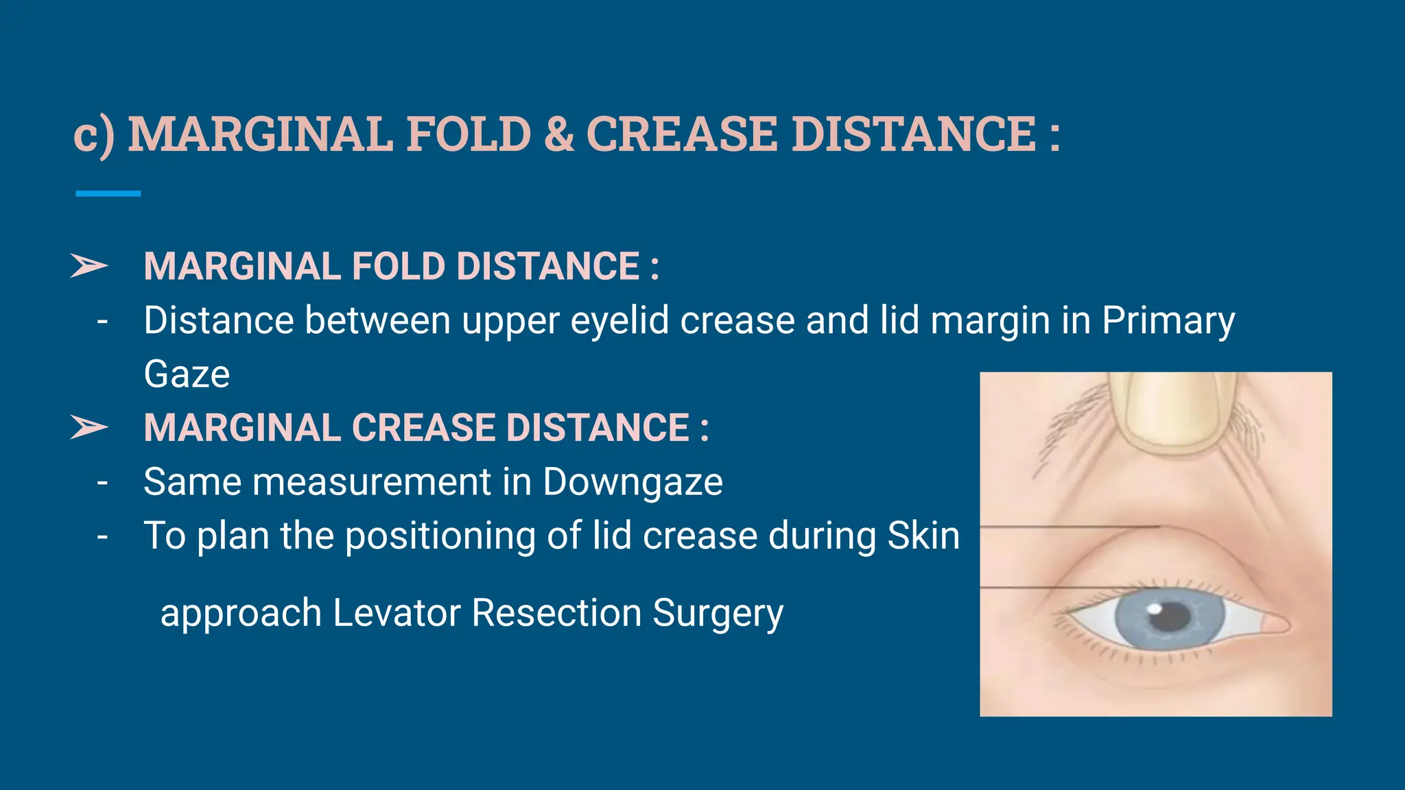 PTOSIS OF UPPER LID AND MANAGEMENT OF PTOSIS | PDF