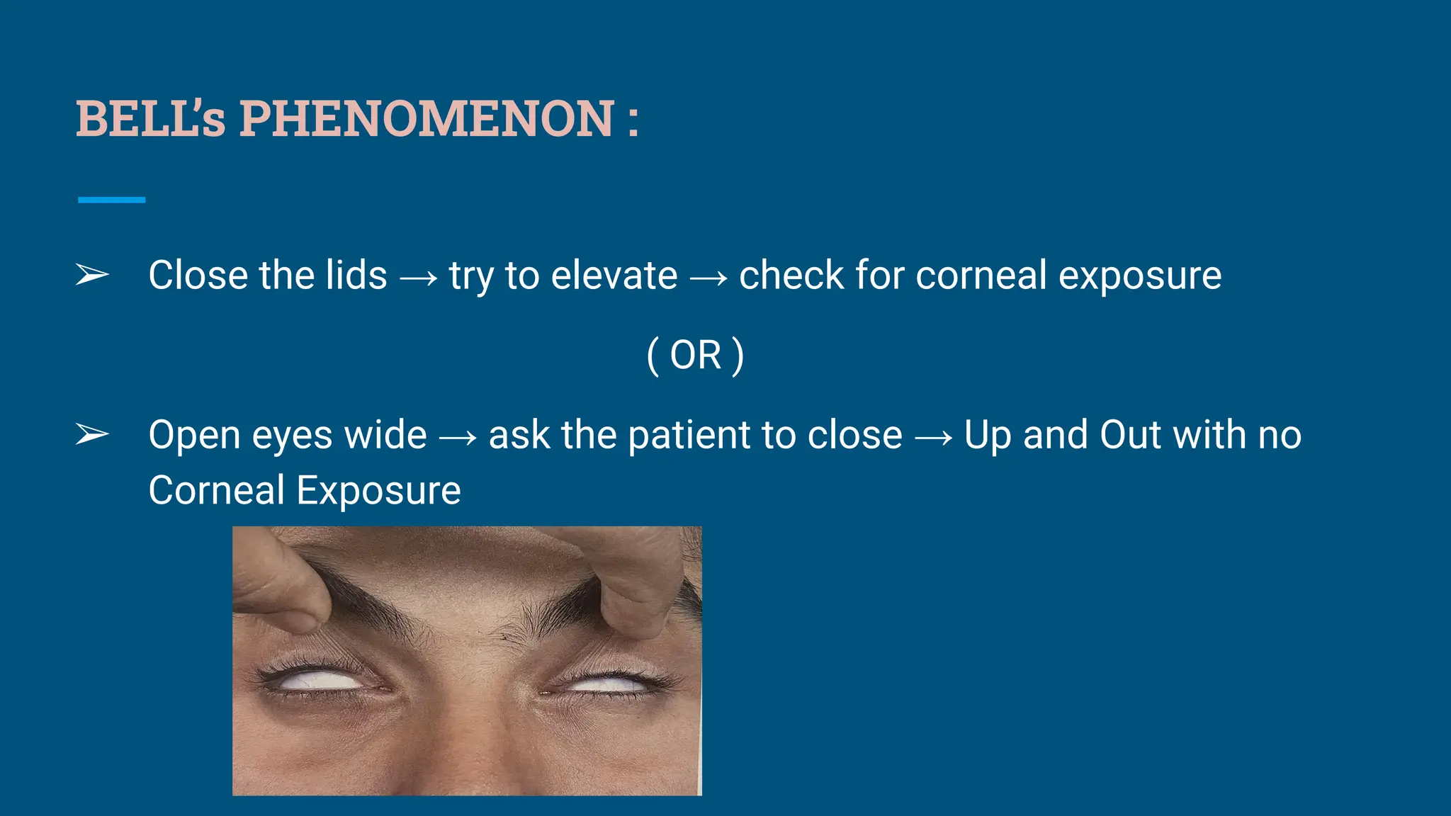 Management Of Ptosis: Acquired Ptosis Results – WTQM